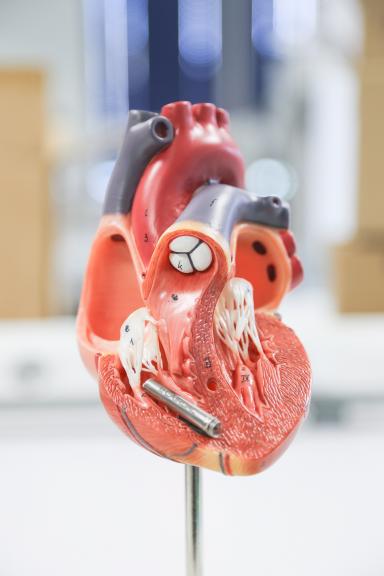 A complete paradigm shift in Cardiac Rhythm Management (CRM) | imec IC-Link