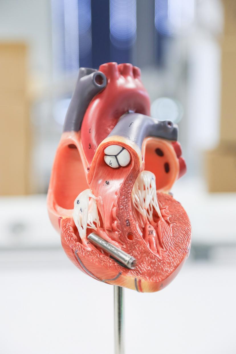 A complete paradigm shift in Cardiac Rhythm Management (CRM) | imec IC-Link